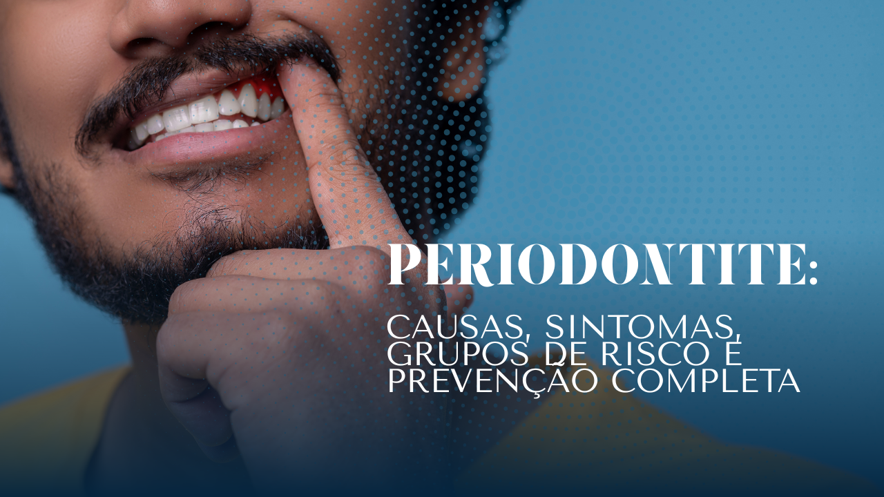Periodontite: causas, sintomas, grupos de risco e prevenção completa ...